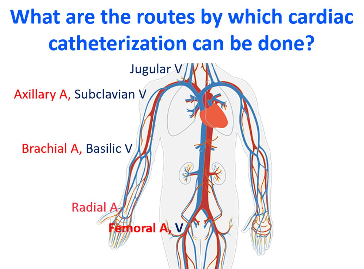 Benefits Of Cardiac Catheterization At Jack Drake Blog