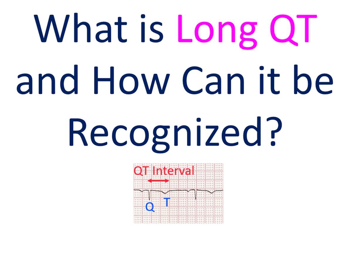 What is long QT syndrome? - All About Heart And Blood Vessels