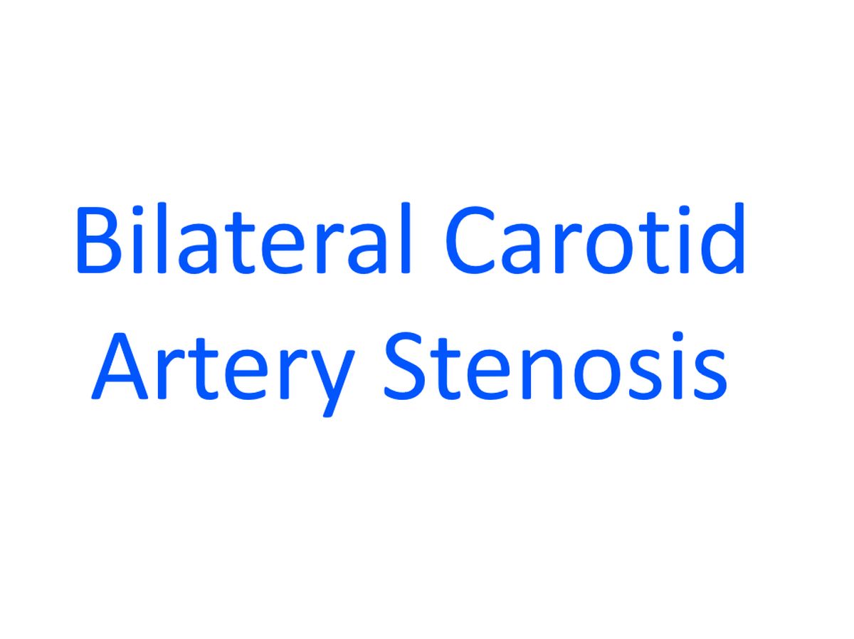 Bilateral carotid artery stenosis - use distal protection filter