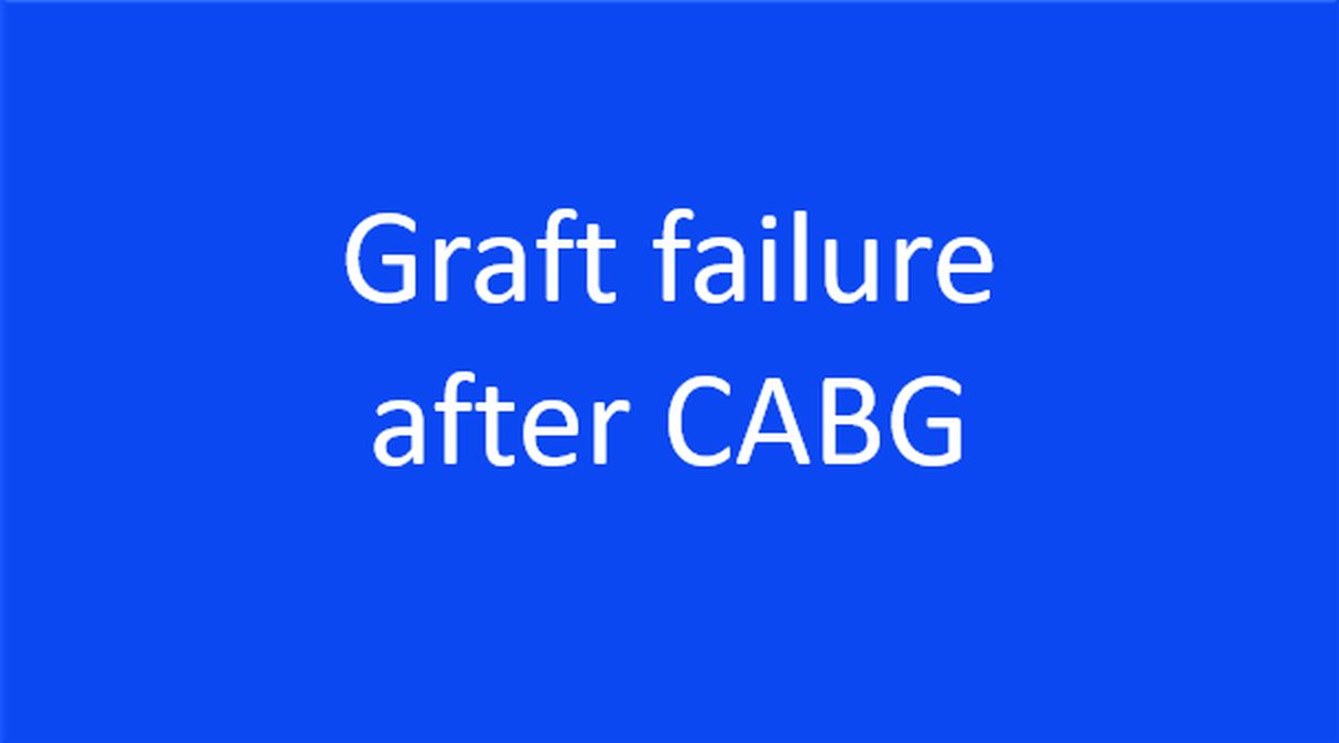 Graft failure after CABG - ischemia in ECG, biomarker elevtion 5 times