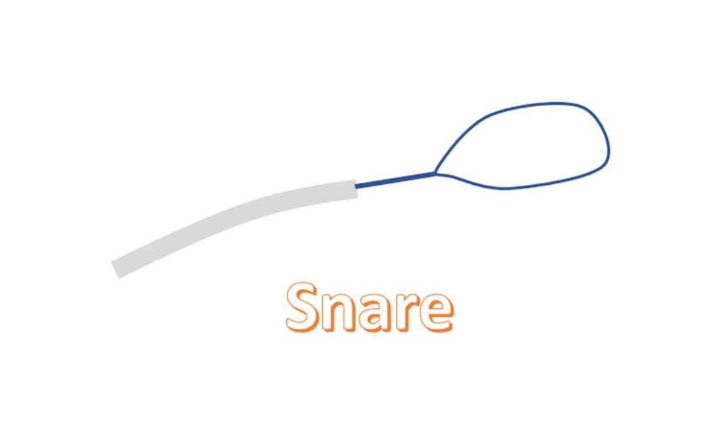 Device closure of atrial septal defect (ASD) - description