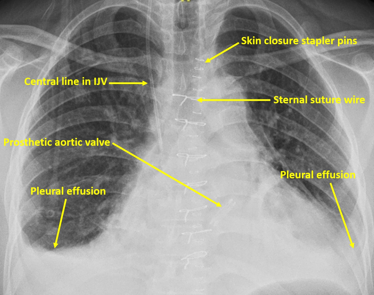 X Ray Quiz 9 All About Cardiovascular System And Disorders Free Nude X Ray Quiz 9 All About Cardiovascular System And Disorders Free Nude