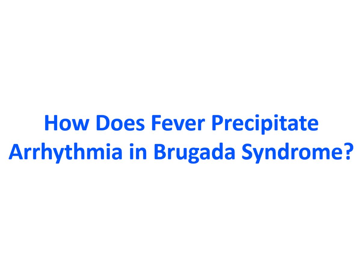 How Does Fever Precipitate Arrhythmia in Brugada Syndrome? - All About ...