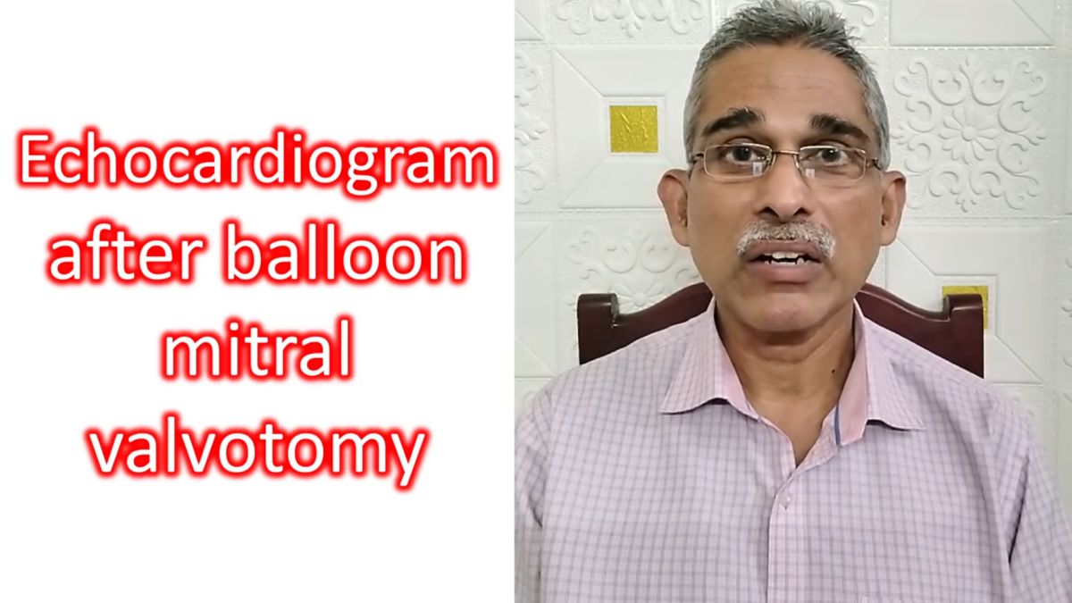 Echocardiogram after balloon mitral valvotomy - All About ...