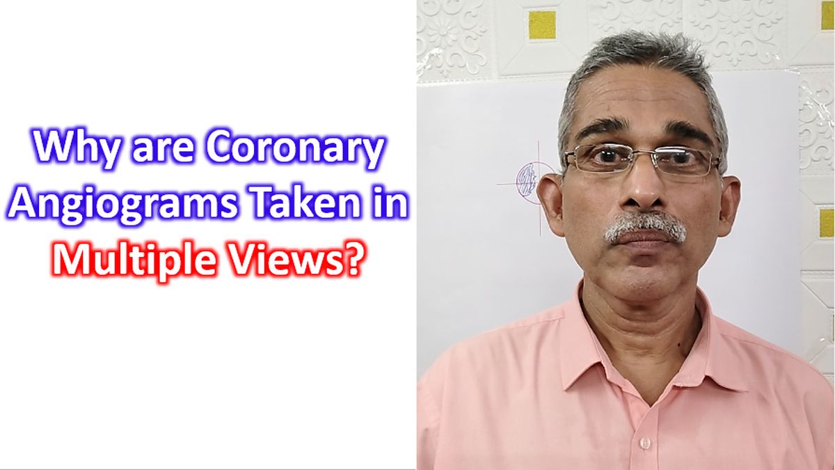 Why are coronary angiograms taken in multiple views? - All About ...