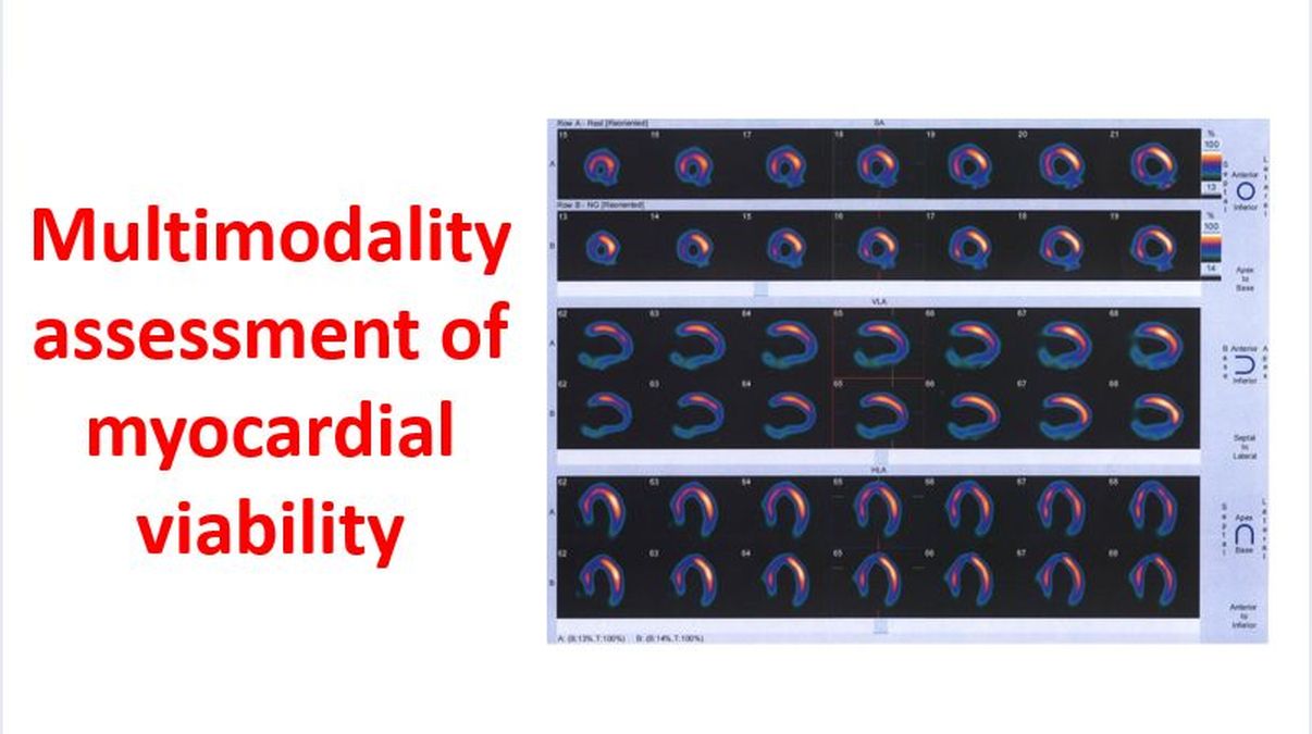 Assessment of myocardial viability by Echo, CT, MRI, SPECT, PET - All ...