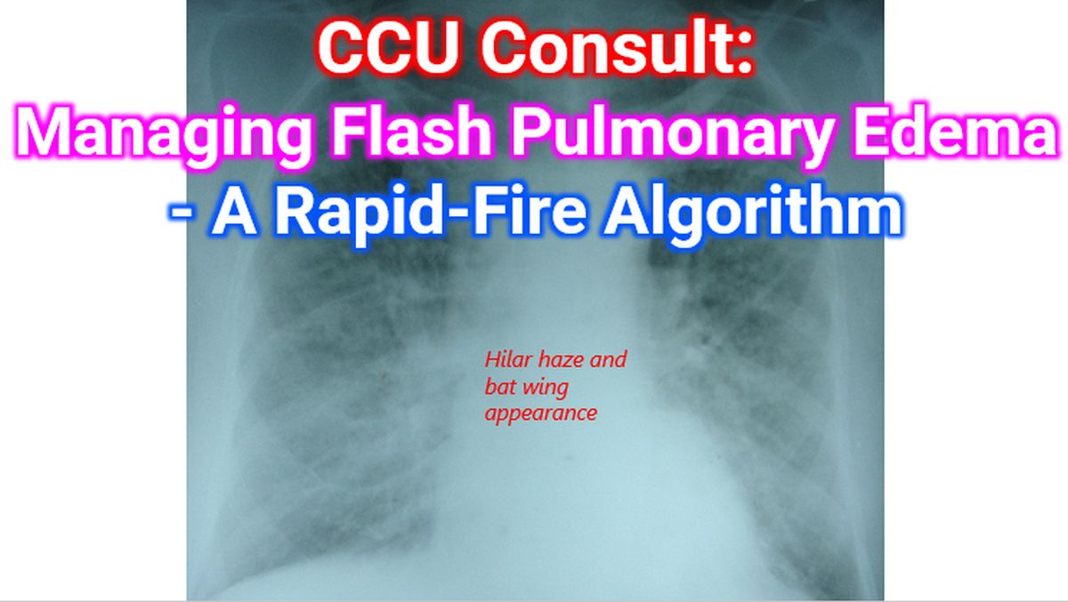 CCU Consult: Managing Flash Pulmonary Edema - A Rapid-Fire Algorithm ...