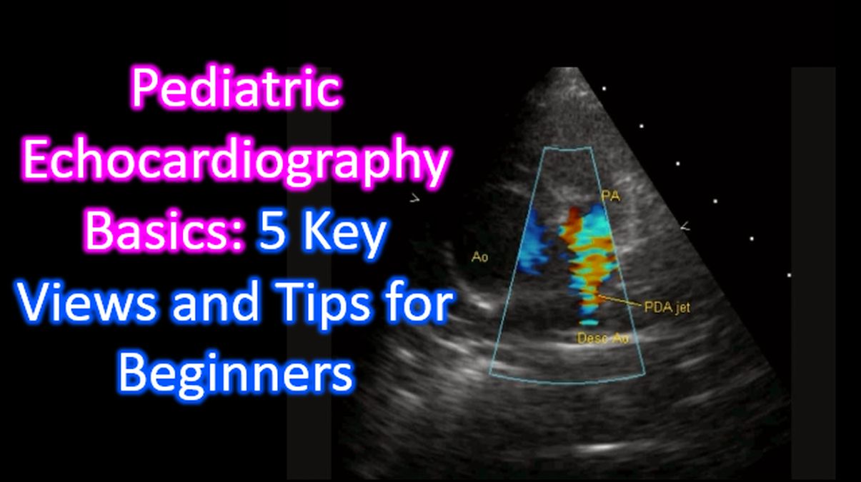 Pediatric Echocardiography Basics: 5 Key Views and Tips for Beginners ...